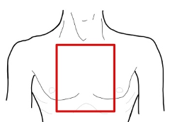cardiac-box – Nerdfallmedizin Archiv