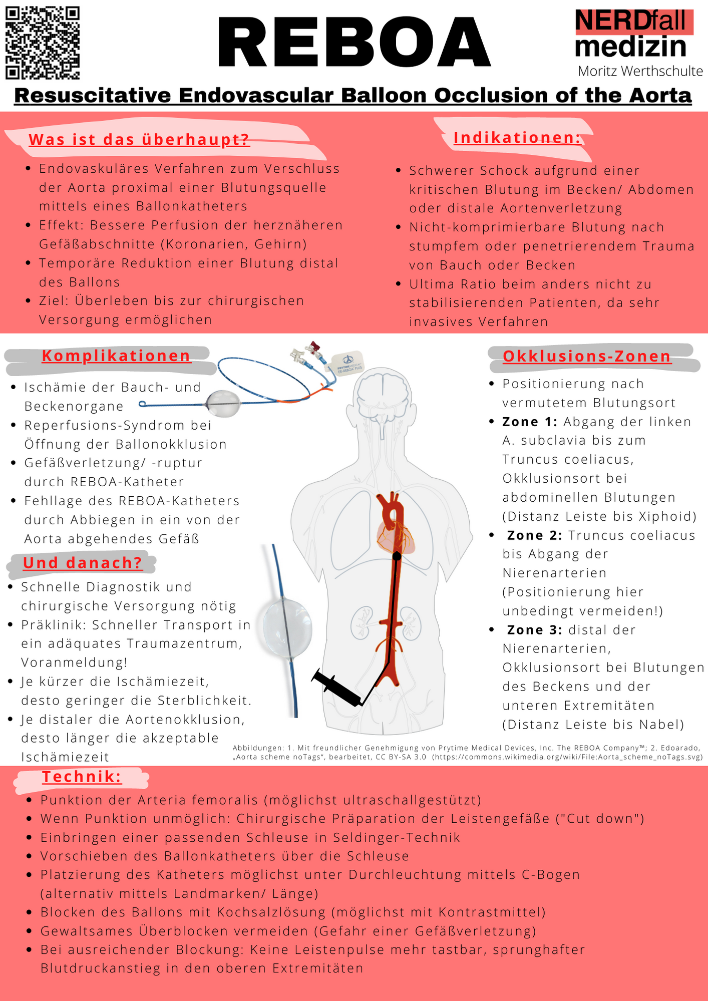 REBOA – Infographik – Nerdfallmedizin Archiv
