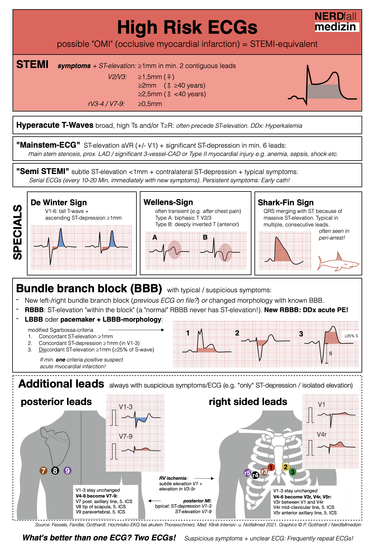 Highrisk ECGs – OMI – Nerdfallmedizin ARCHIV
